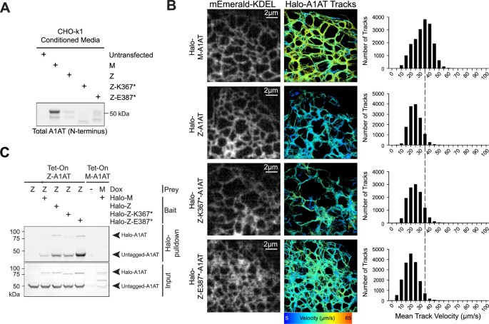Selection for somatic escape variants in SERPINA1 in the liver of ...