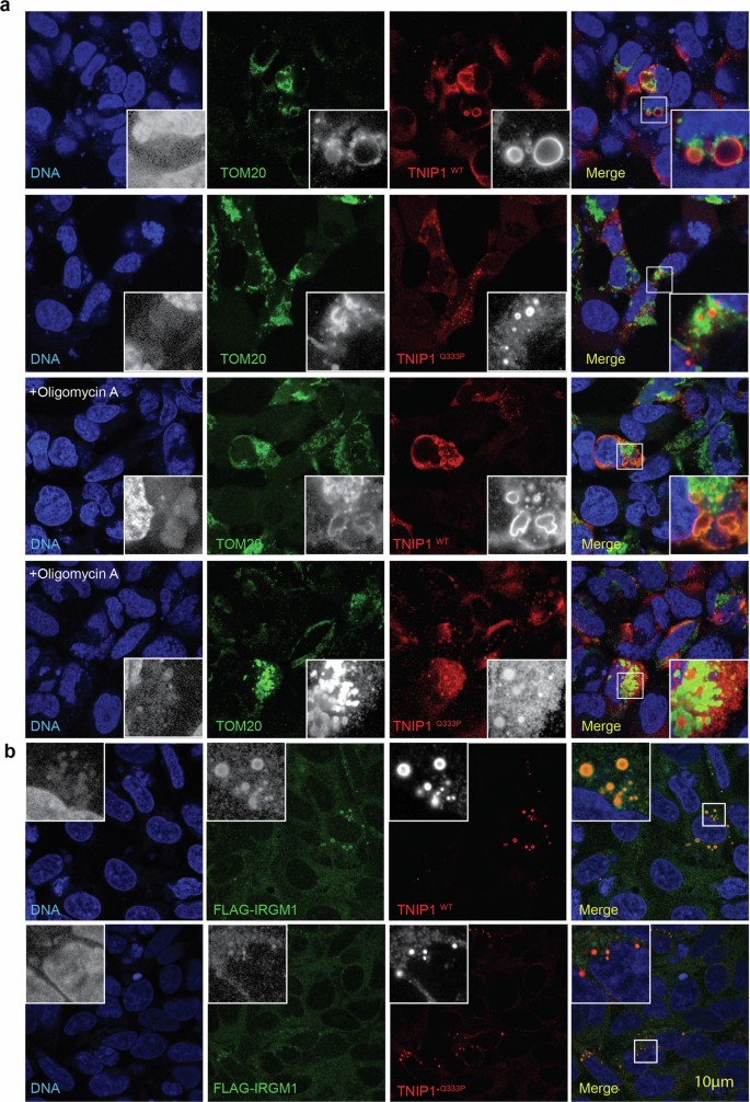 A TNIP1-driven systemic autoimmune disorder with elevated IgG4 | Nature ...