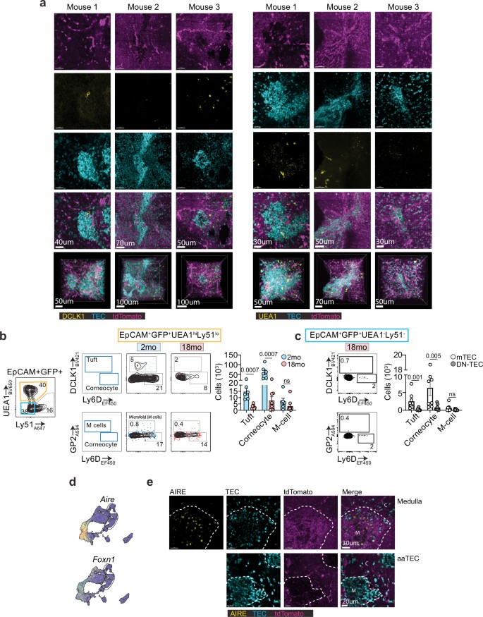 Age-related epithelial defects limit thymic function and regeneration ...
