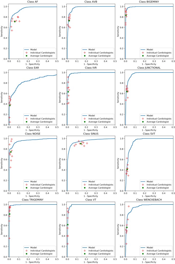 Cardiologist-level arrhythmia detection and classification in ...