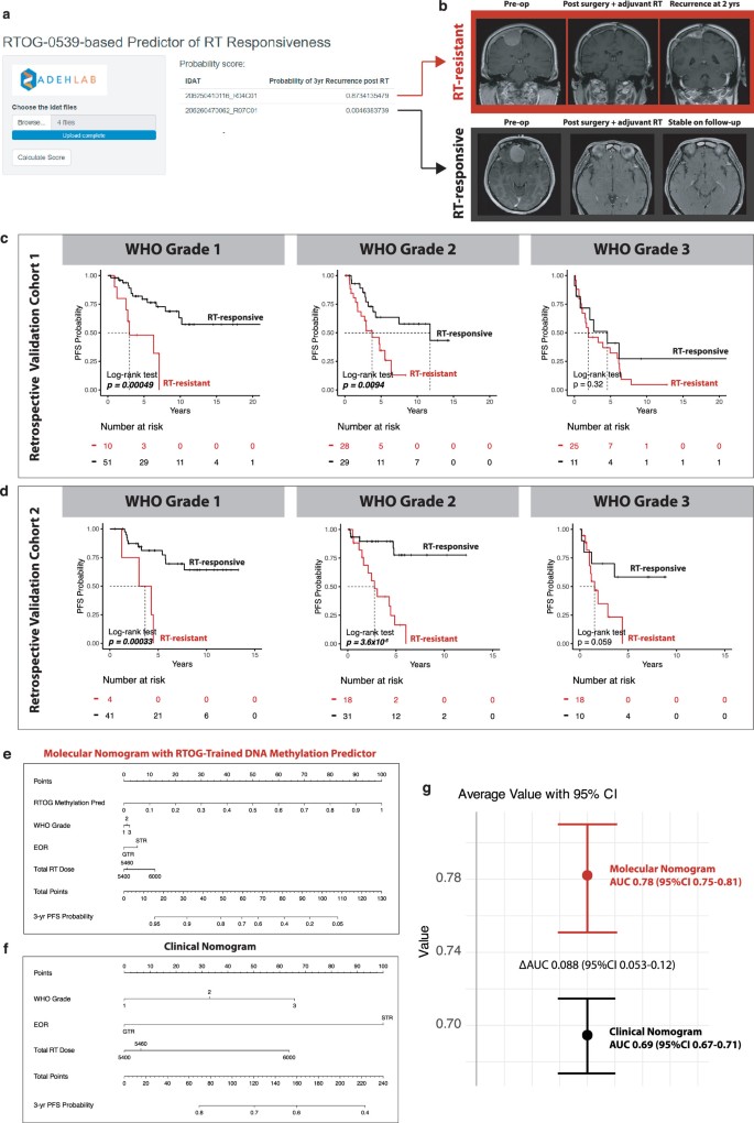 Molecular classification to refine surgical and radiotherapeutic ...