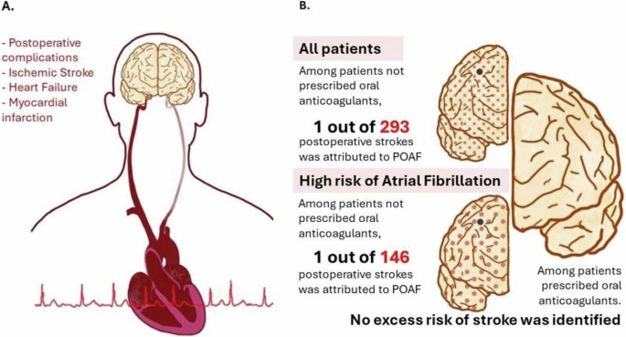 Role of anticoagulation therapy in modifying stroke risk associated with new-onset atrial ...