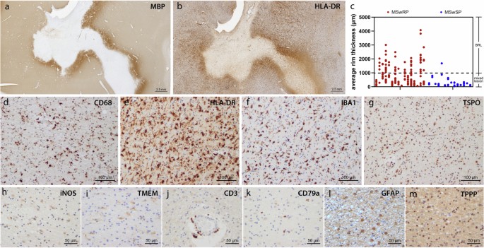 Broad rim lesions are a new pathological and imaging biomarker for ...