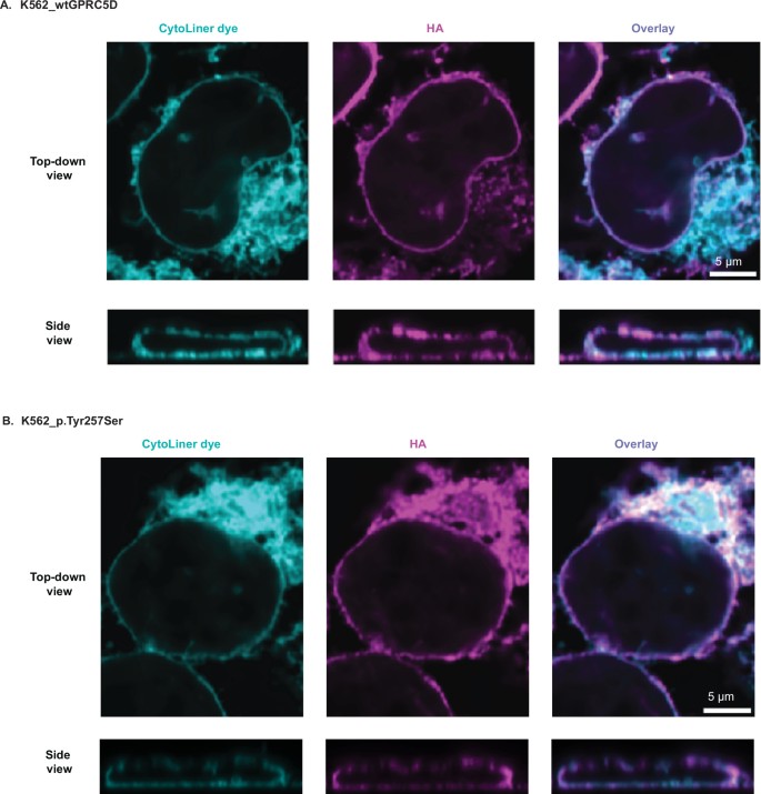 Multimodal antigenic escape to GPRC5D-targeted T cell engagers in ...