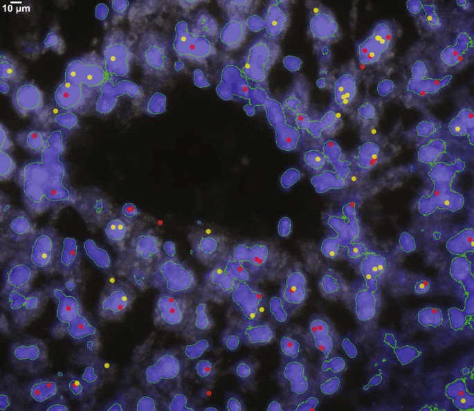 Highly specific multiplexed RNA imaging in tissues with split-FISH ...