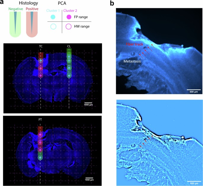 Vibrational fiber photometry: label-free and reporter-free minimally ...