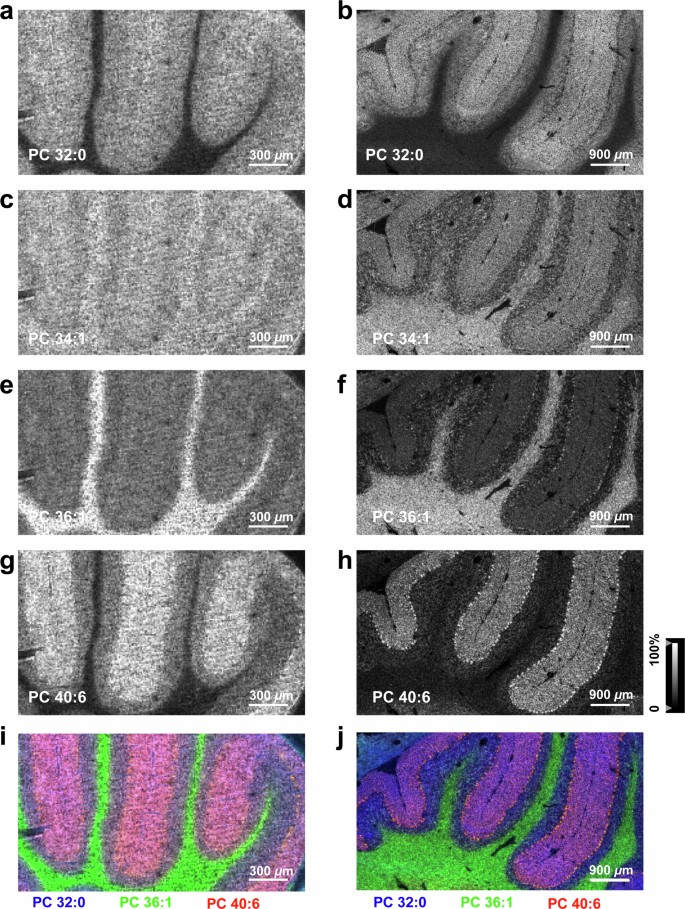 TEMI: tissue-expansion mass-spectrometry imaging | Nature Methods