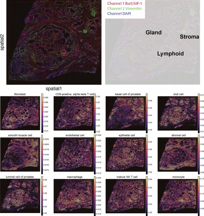 Scvi-hub: an actionable repository for model-driven single-cell ...