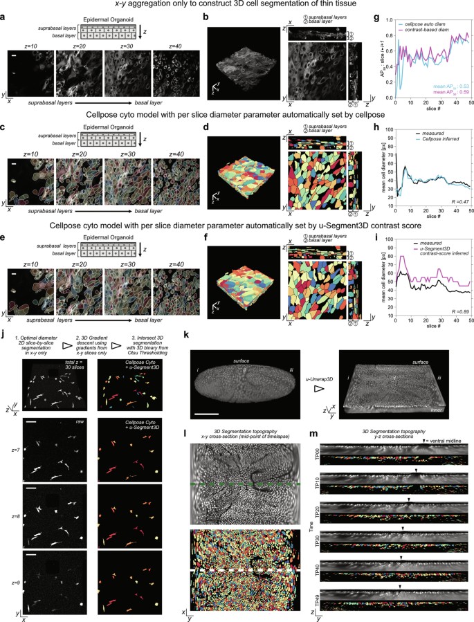 Universal consensus 3D segmentation of cells from 2D segmented stacks ...