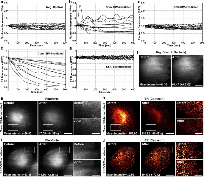 Bio-friendly and high-precision super-resolution imaging through self ...
