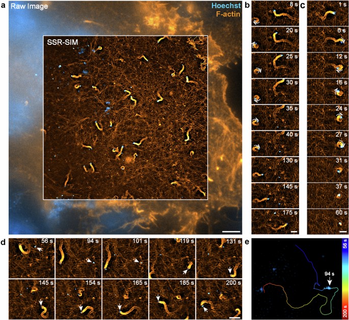 Bio-friendly and high-precision super-resolution imaging through self ...