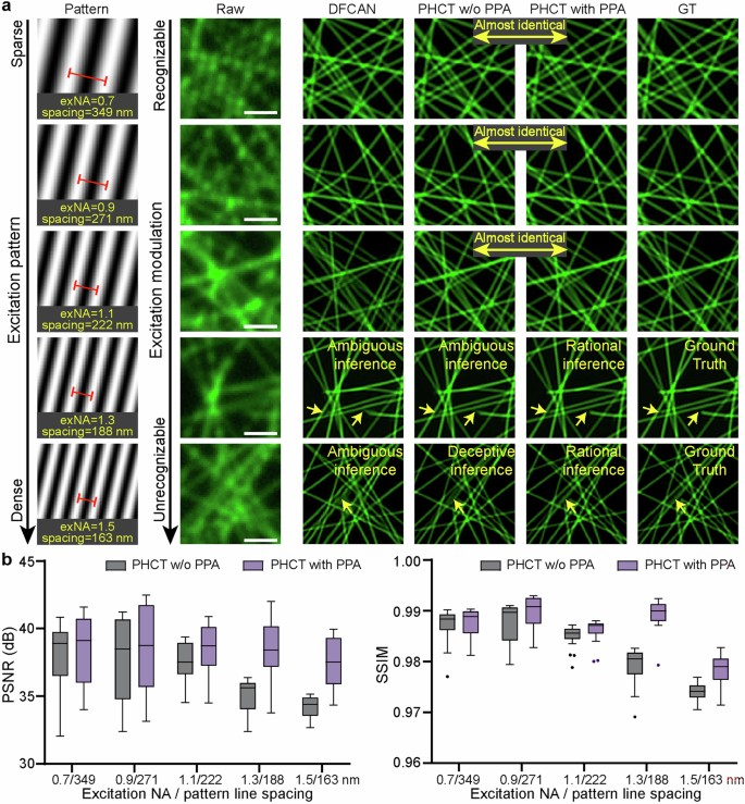 Bio-friendly and high-precision super-resolution imaging through self ...