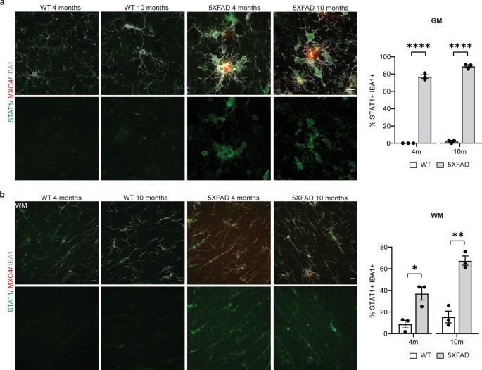 T cell-mediated microglial activation triggers myelin pathology in a ...