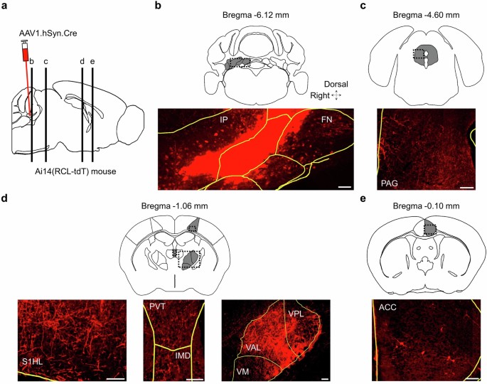Cerebellar Bergmann glia integrate noxious information and modulate ...