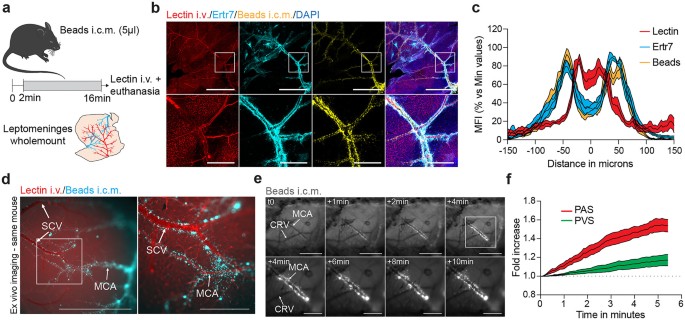 A route for cerebrospinal fluid flow through leptomeningeal arterial ...