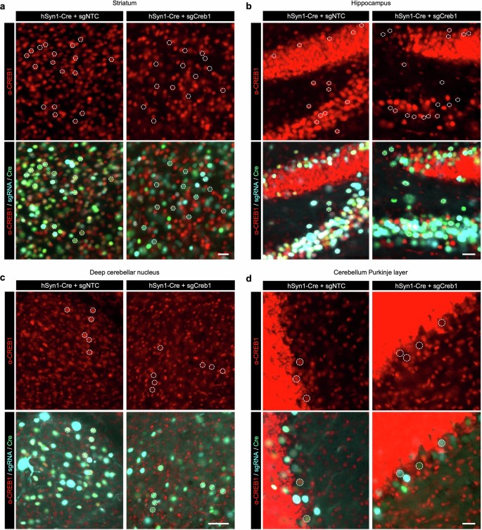 CRISPR screening by AAV episome-sequencing (CrAAVe-seq): a scalable ...