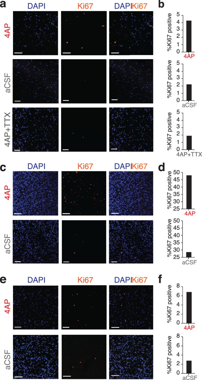 Increased neural excitability and glioma synaptic activity drives ...