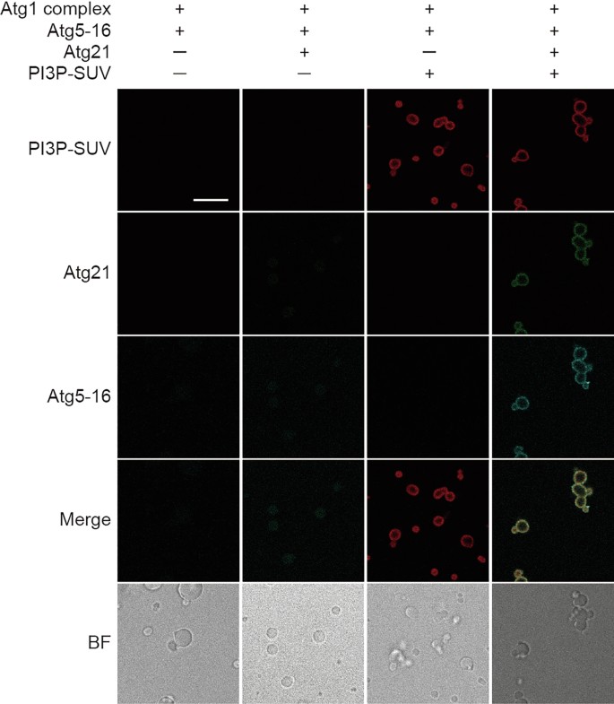 Phase separation promotes Atg8 lipidation and vesicle condensation for ...