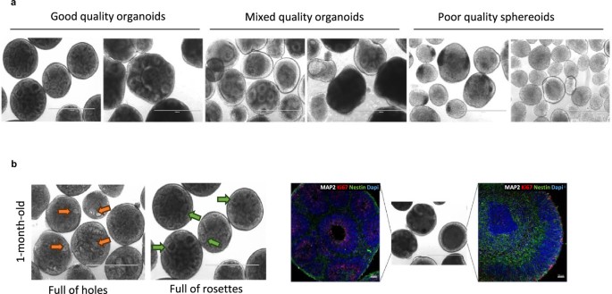 Generation of ‘semi-guided’ cortical organoids with complex neural ...