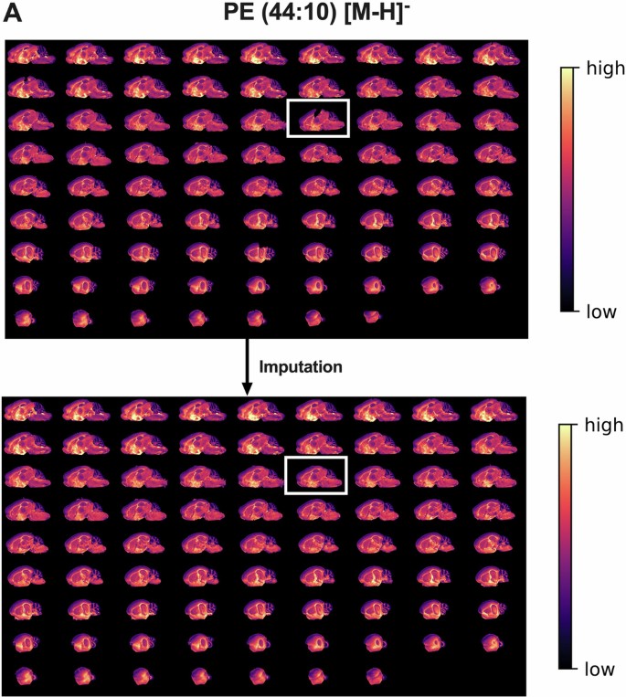AI-driven framework to map the brain metabolome in three dimensions | Nature Metabolism