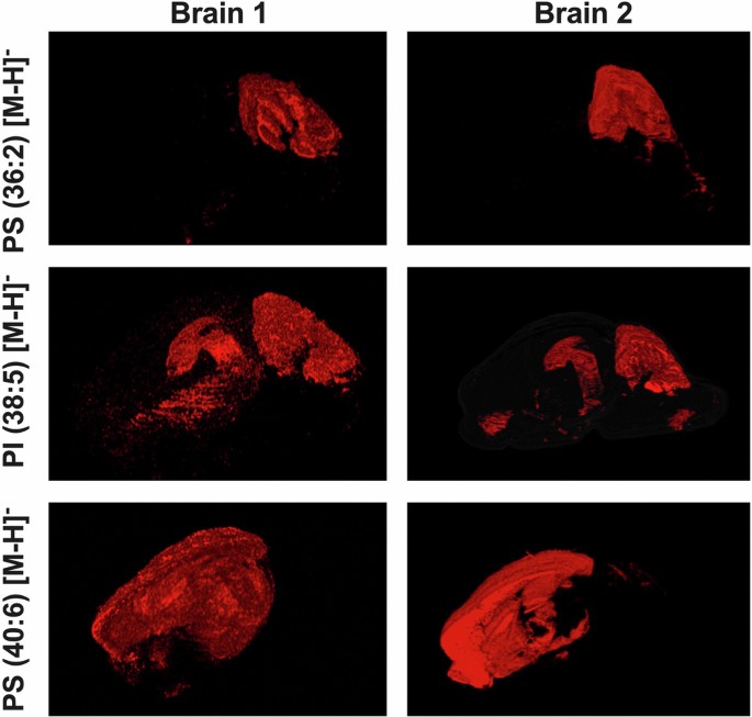 AI-driven framework to map the brain metabolome in three dimensions | Nature Metabolism