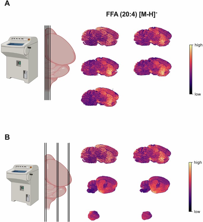 AI-driven framework to map the brain metabolome in three dimensions ...