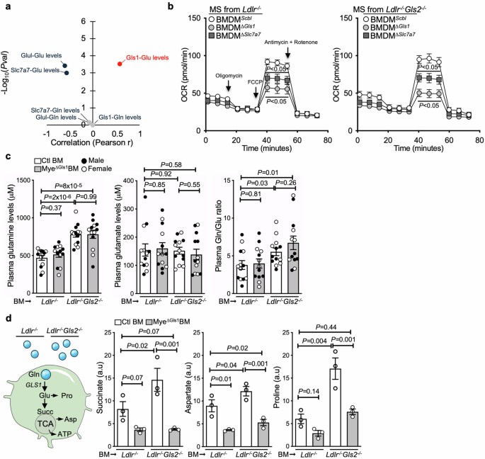 Slc7a7 licenses macrophage glutaminolysis for restorative functions in ...