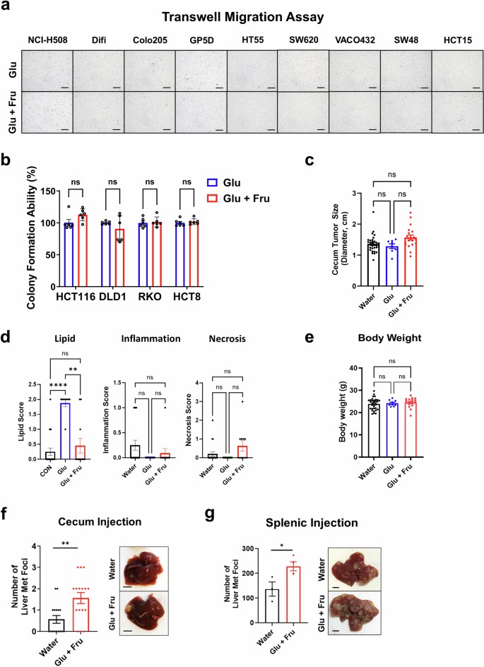 Fructose and glucose from sugary drinks enhance colorectal cancer ...