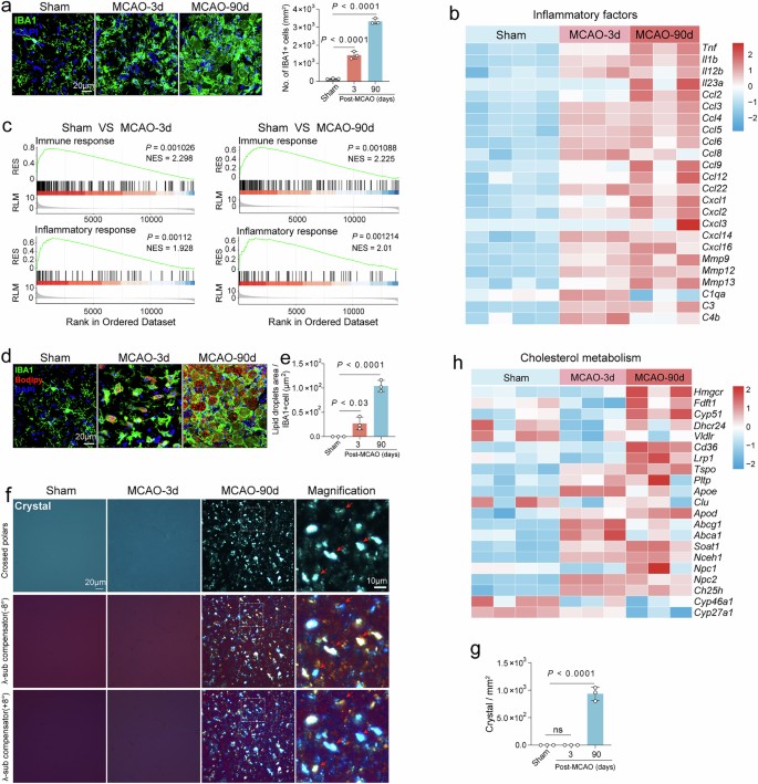Cholesterol metabolic reprogramming mediates microglia-induced chronic ...