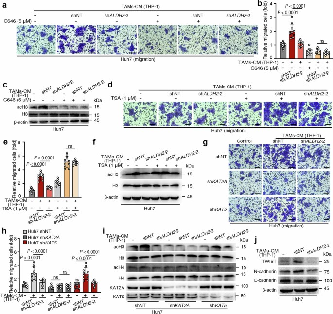 Tumour-associated macrophages serve as an acetate reservoir to drive ...