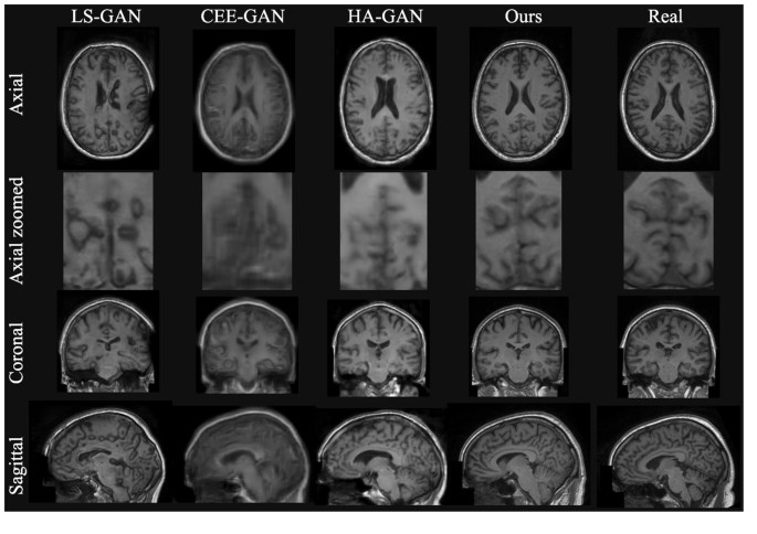 Realistic morphology-preserving generative modelling of the brain | Nature Machine Intelligence
