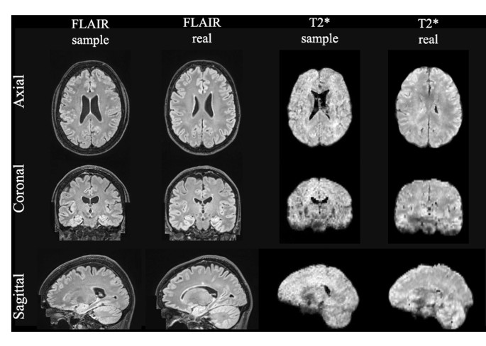 Realistic morphology-preserving generative modelling of the brain | Nature Machine Intelligence