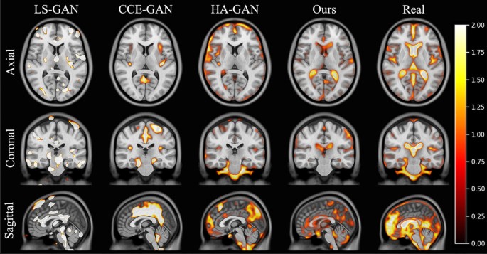 Realistic morphology-preserving generative modelling of the brain ...
