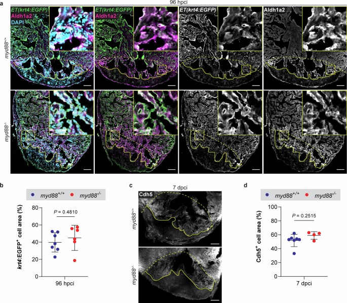 The innate immune regulator MyD88 dampens fibrosis during zebrafish ...