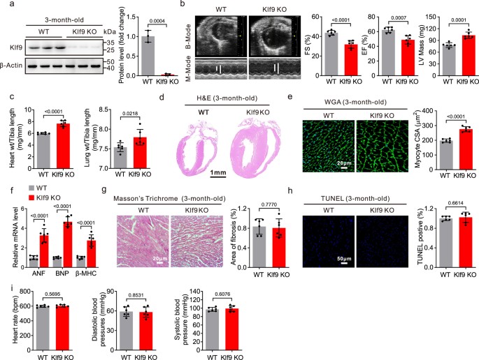 Klf9 is essential for cardiac mitochondrial homeostasis | Nature ...