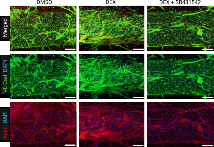 Human ocular fluid outflow on-chip reveals trabecular meshwork-mediated ...