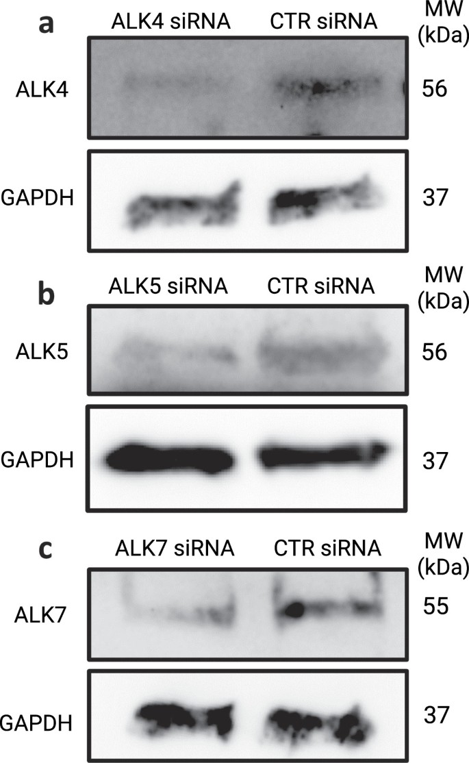 Human ocular fluid outflow on-chip reveals trabecular meshwork-mediated ...