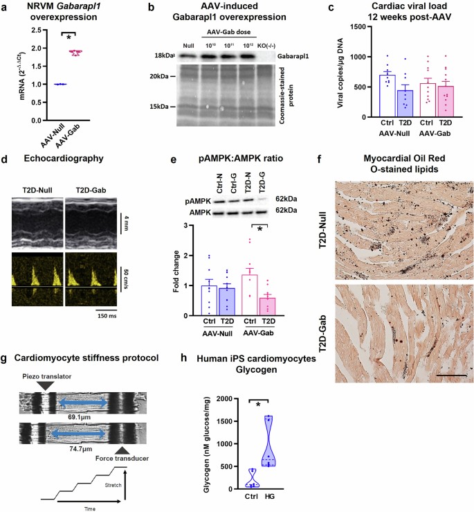 Targeted glycophagy ATG8 therapy reverses diabetic heart disease in ...