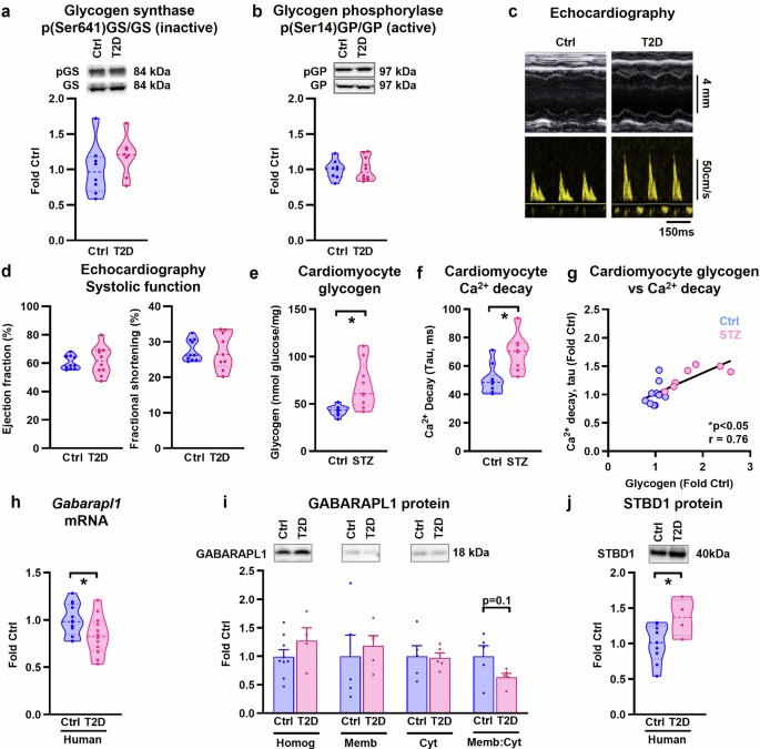 Targeted glycophagy ATG8 therapy reverses diabetic heart disease in ...