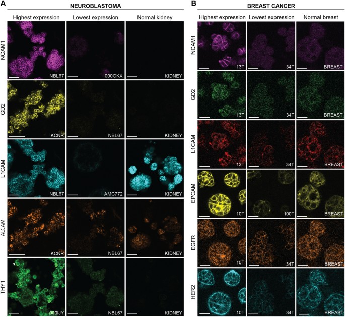 A multispectral 3D live organoid imaging platform to screen probes for ...