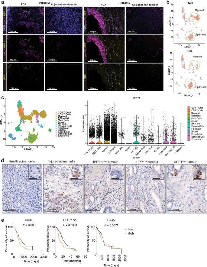 Uridine-derived ribose fuels glucose-restricted pancreatic cancer | Nature