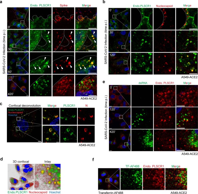 PLSCR1 is a cell-autonomous defence factor against SARS-CoV-2 infection ...