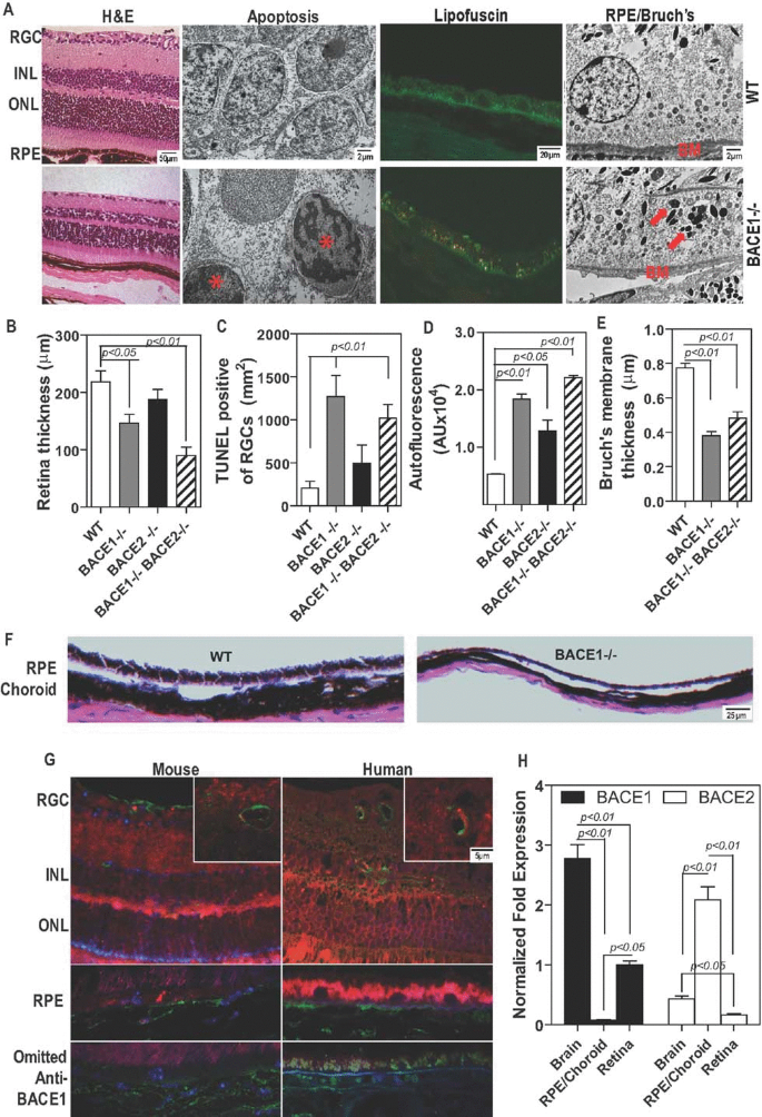 β‐Secretase (BACE1) inhibition causes retinal pathology by vascular ...