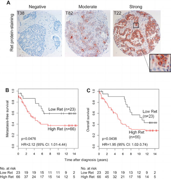 Ret inhibition decreases growth and metastatic potential of estrogen ...