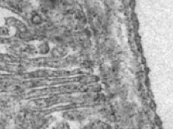 Local acting Sticky‐trap inhibits vascular endothelial growth factor ...