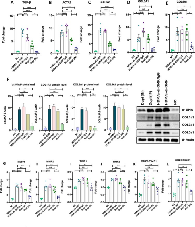 Intranasal dupilumab improves responsiveness to steroid in an asthma ...
