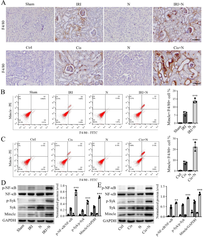 SARS-CoV-2 nucleocapsid protein induces a Mincle-dependent macrophage ...