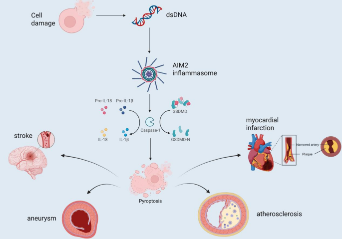The role of absent in melanoma 2 (AIM2) in cardiovascular diseases ...