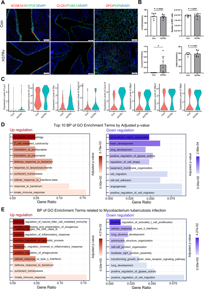 Lung epithelial injury impairs early host immune responses to Mycobacterium tuberculosis ...