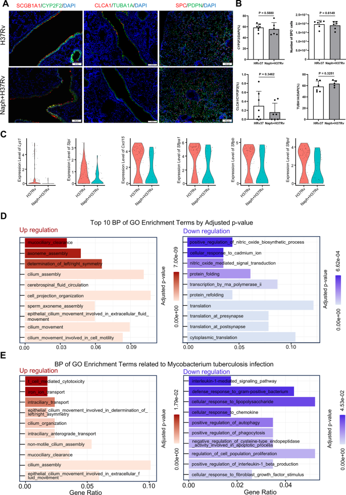 Lung epithelial injury impairs early host immune responses to ...